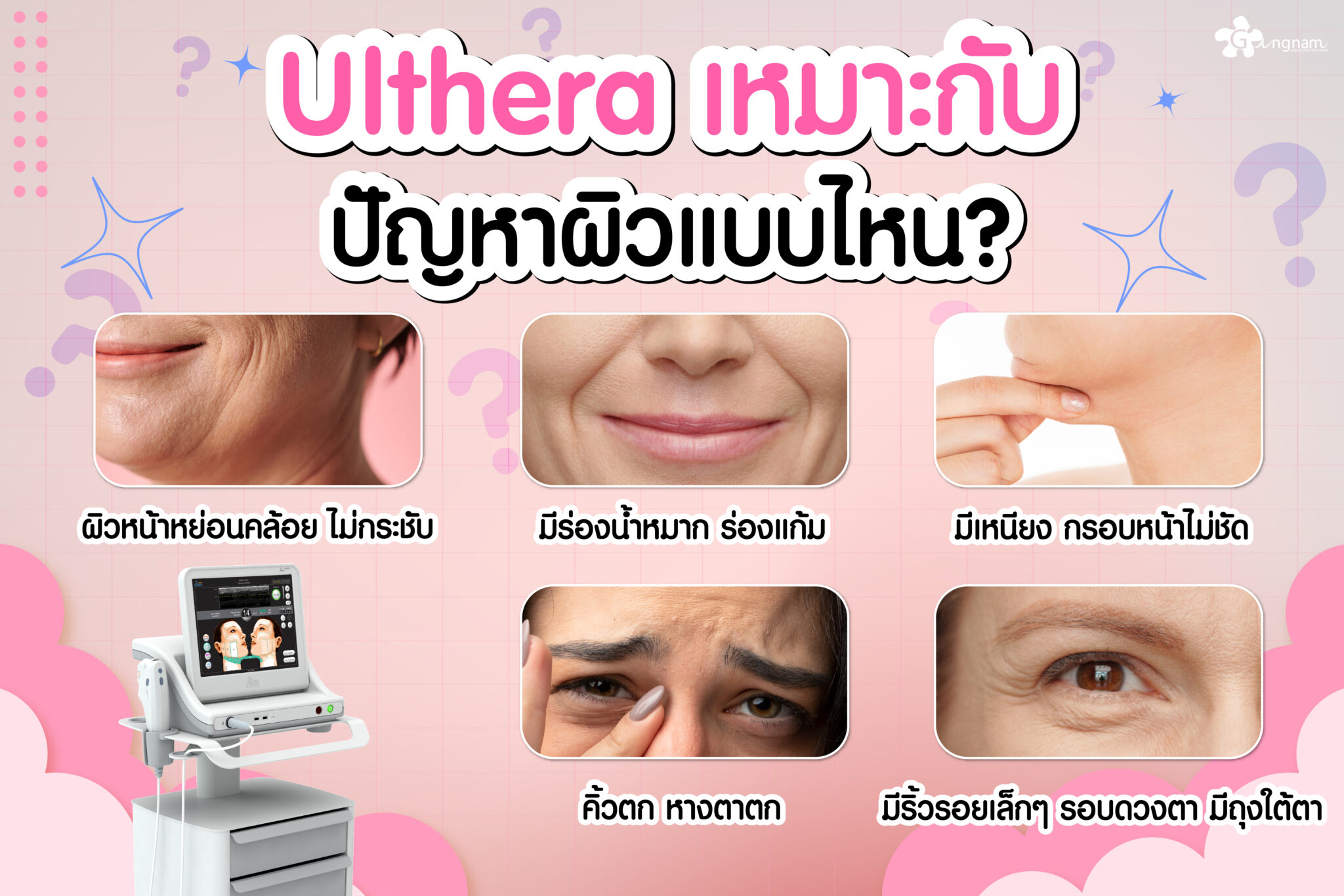 รีวิวที่จริงใจ! Ulthera’