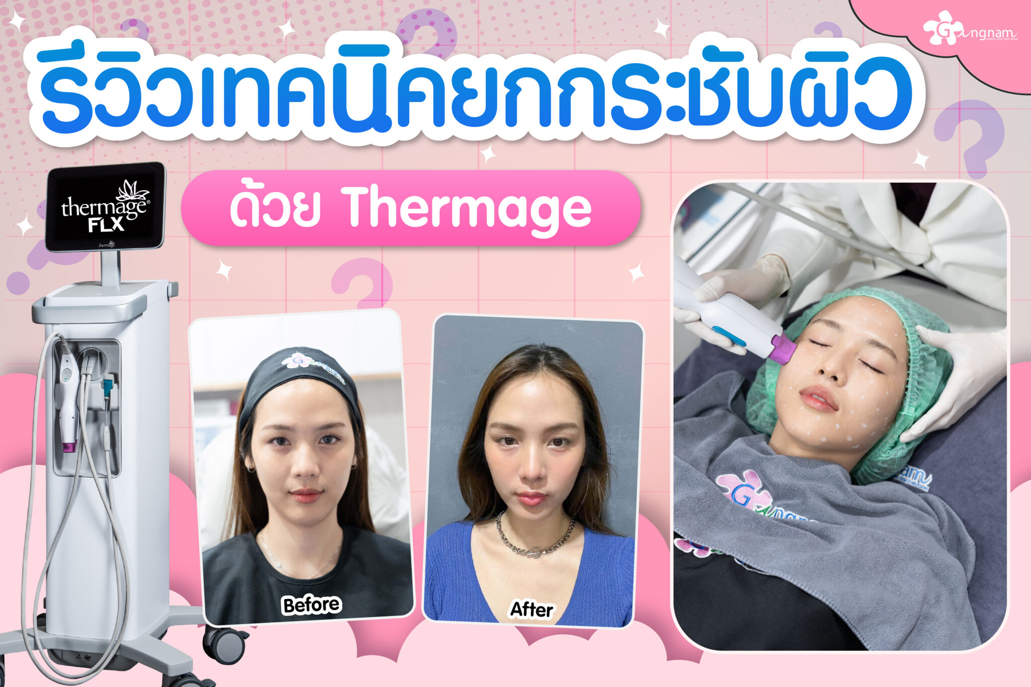 เทคนิคยกกระชับ Thermage