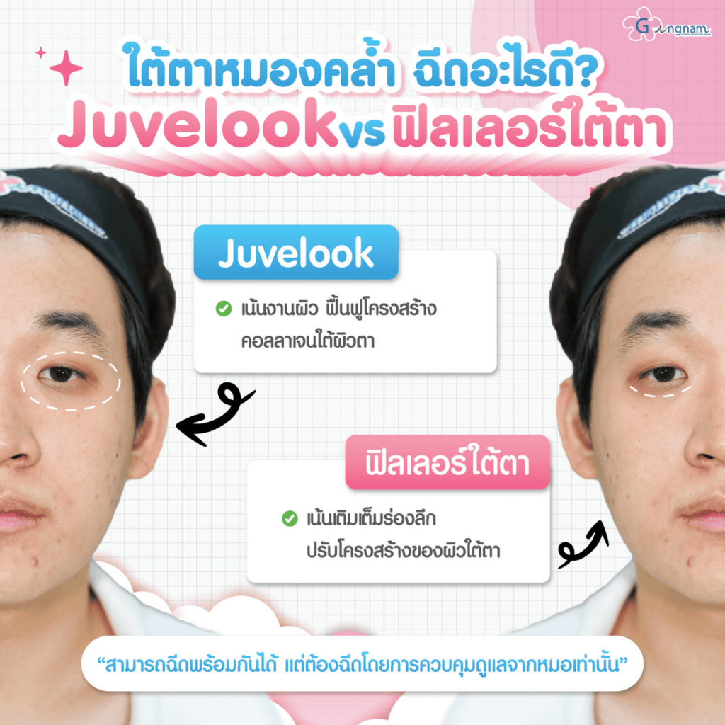 Juvelook คืออะไร? เหมาะกับใคร ต้องฉีดกี่ครั้ง? ช่วยเรื่องอะไรได้บ้าง ...