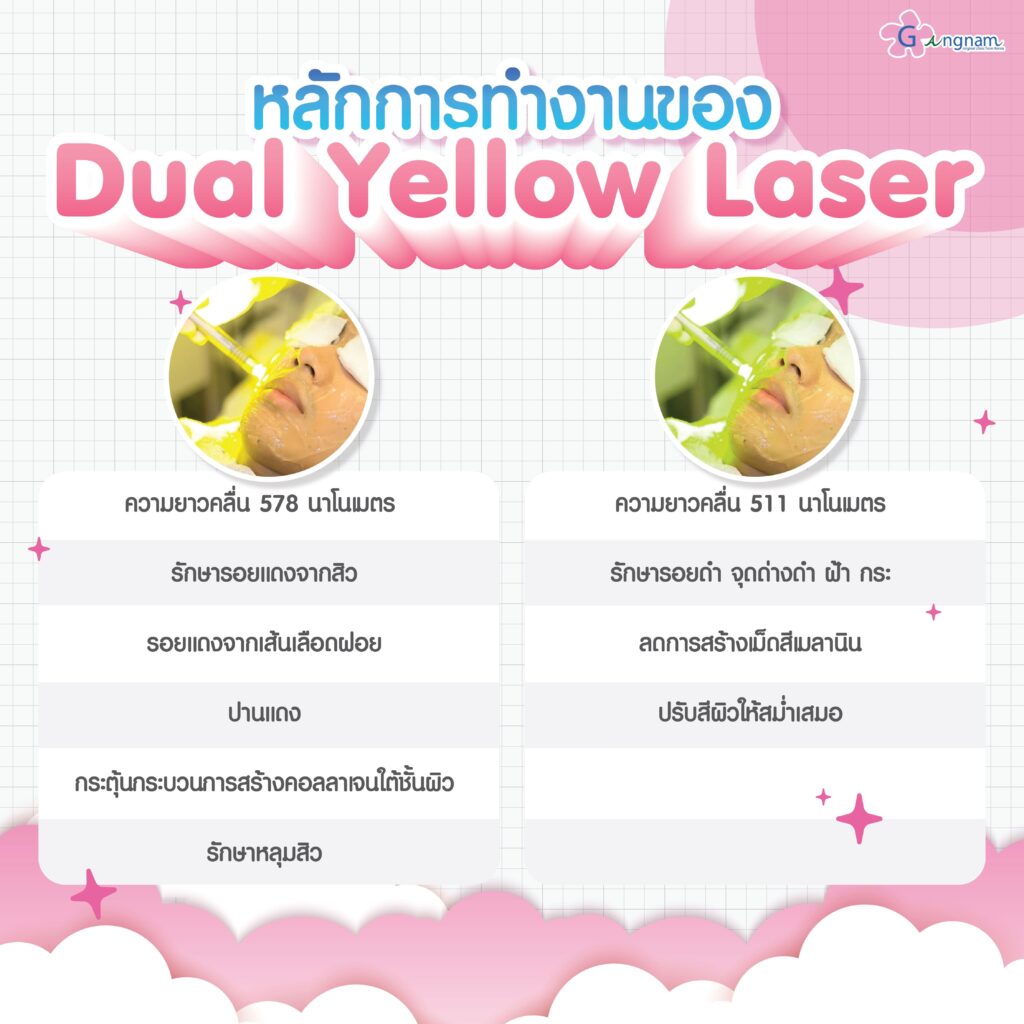 Dual Yellow Laser อันตรายไหม ? ทำที่ไหนดี ? ราคาเท่าไหร่