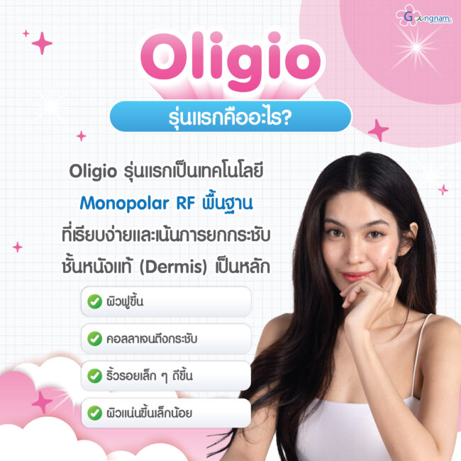 Oligio X ยุคใหม่ของการยกกระชับที่ลึกถึง SMAS พร้อมผลลัพธ์ชัดตั้งแต่ครั้งแรก